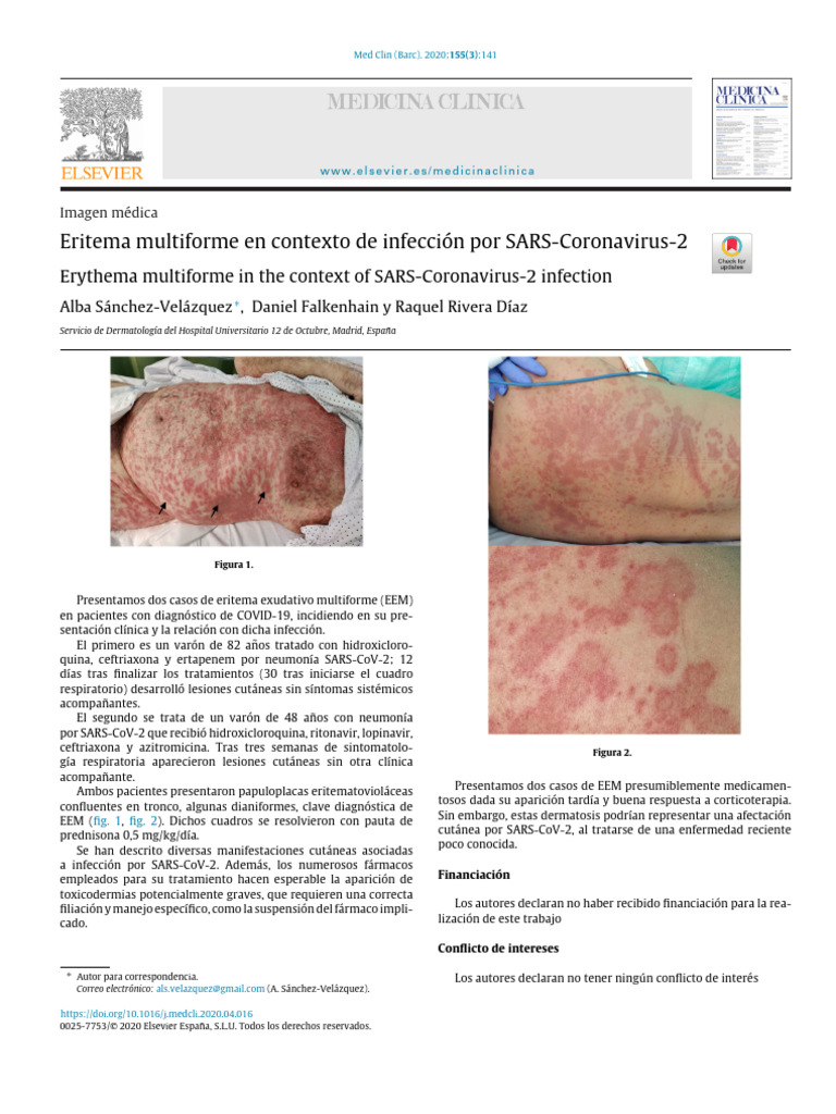 Eritema Multiforme en Contexto de Infecci N Por SARS Coro 2020 Medicina CL N | PDF | Neumonía ...
