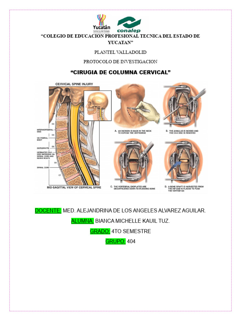Cirugia de Columna Cervical | PDF | La columna vertebral | Vértebra
