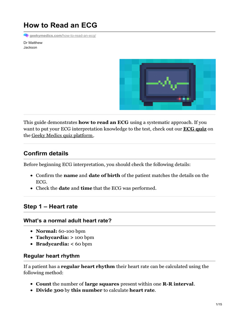 How To Read An ECG | PDF | Electrocardiography | Cardiovascular Diseases