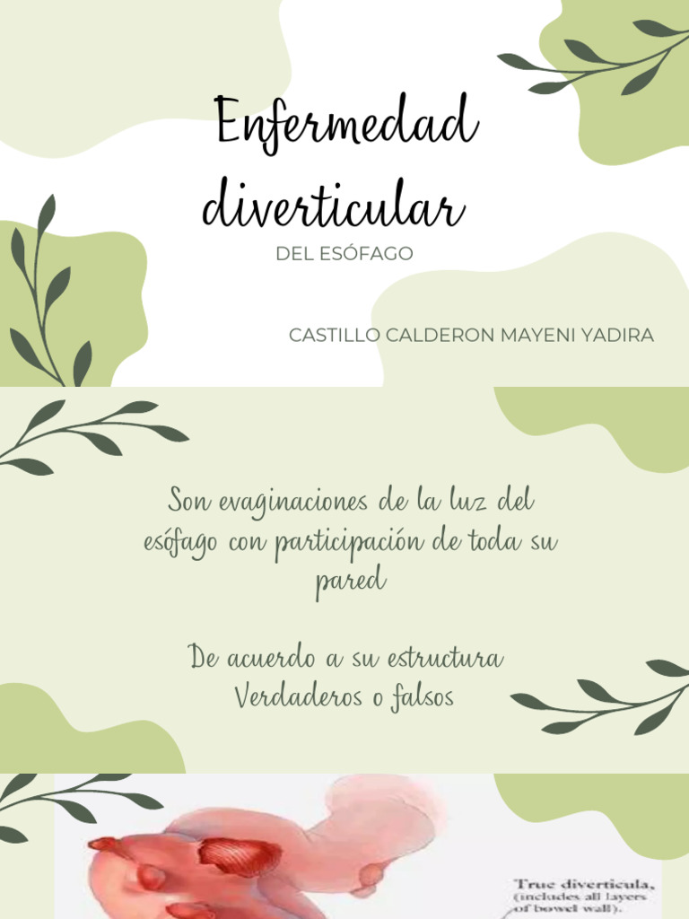 Enfermedad Diverticular Del Esófago | PDF | La enfermedad por reflujo ...