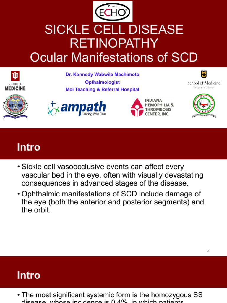 Sickle Cell Retinopathy Overview | PDF | Human Eye | Clinical Medicine