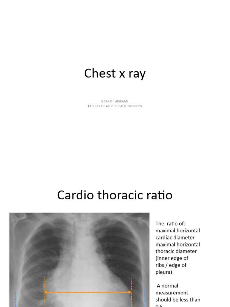 Understanding Chest X-Ray Findings | PDF | Science & Mathematics