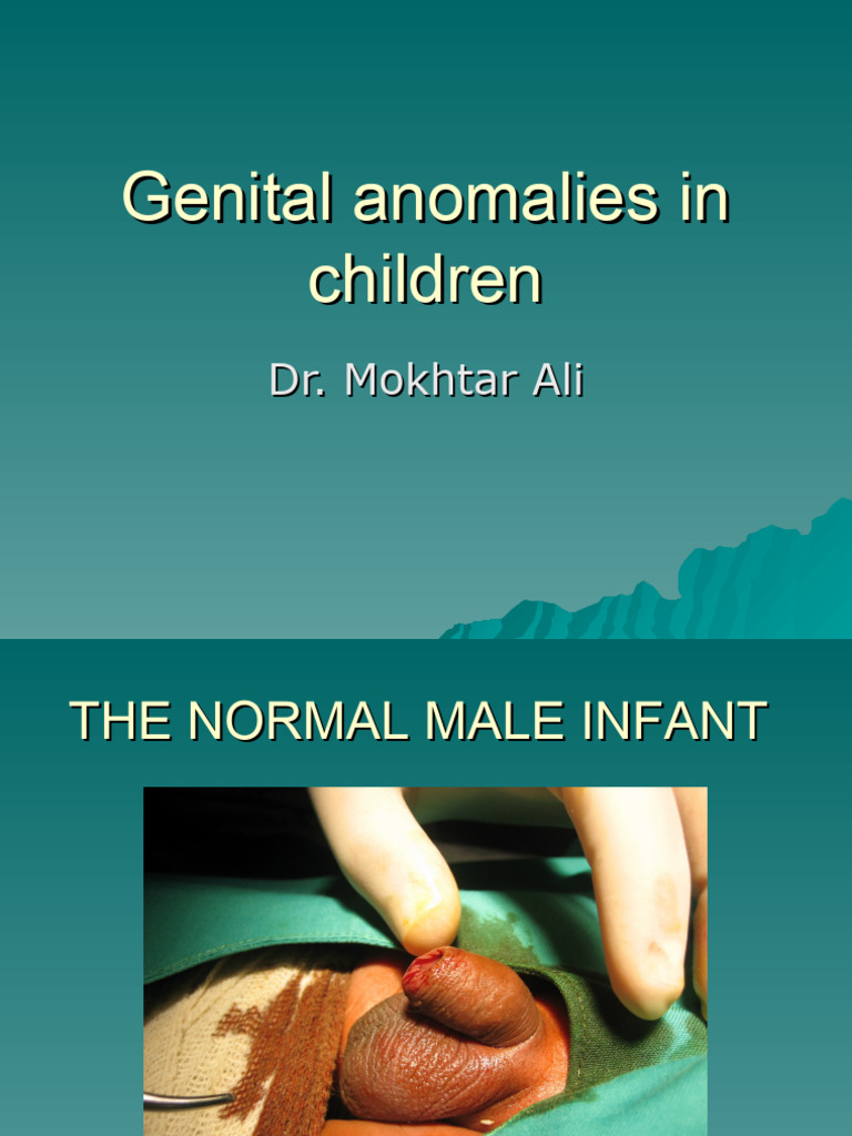 Genital Anomalies in Children Explained | PDF | Urology | Sexual Anatomy