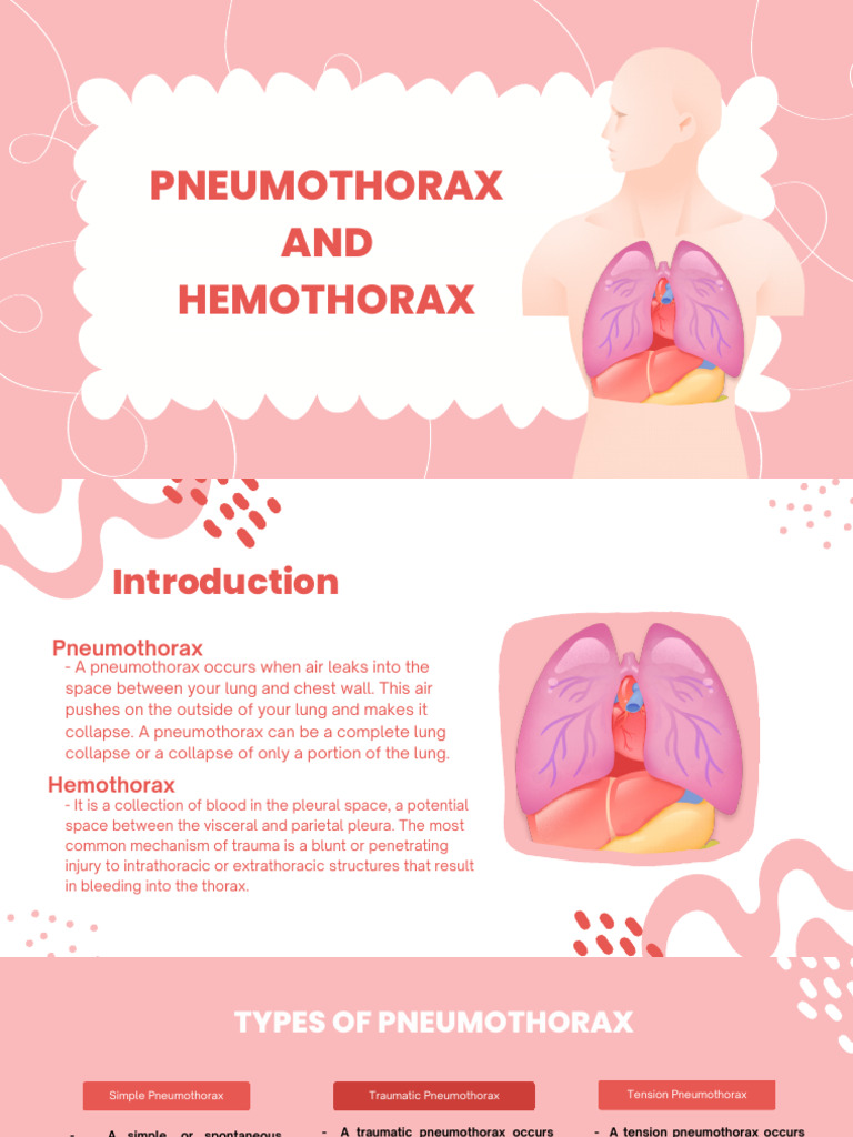 Pneumothorax and Hemothorax | PDF | Thorax | Lung