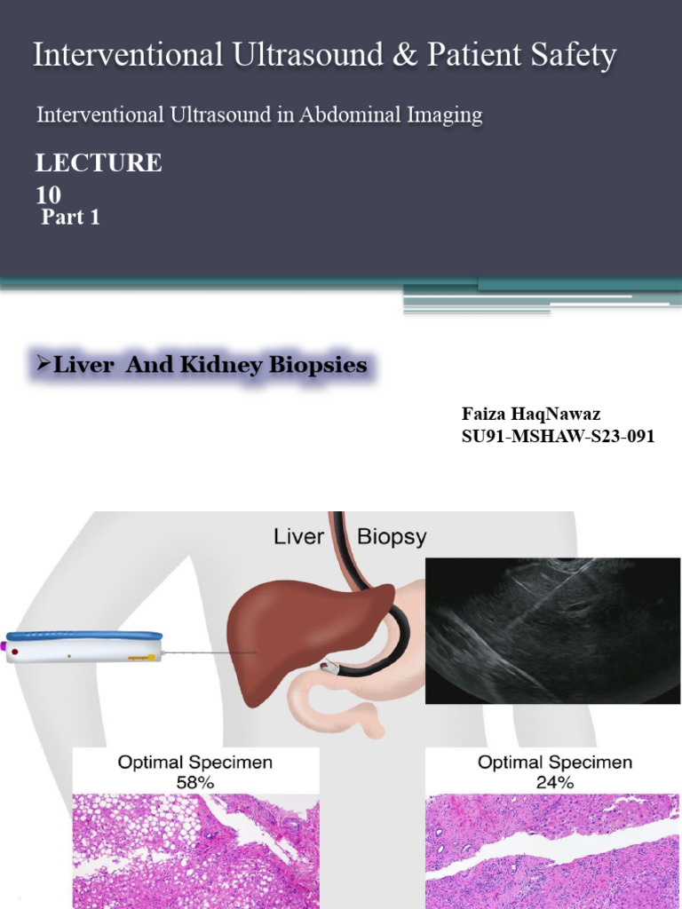 IR LCTR 10 Part 1 | PDF | Cirrhosis | Biopsy