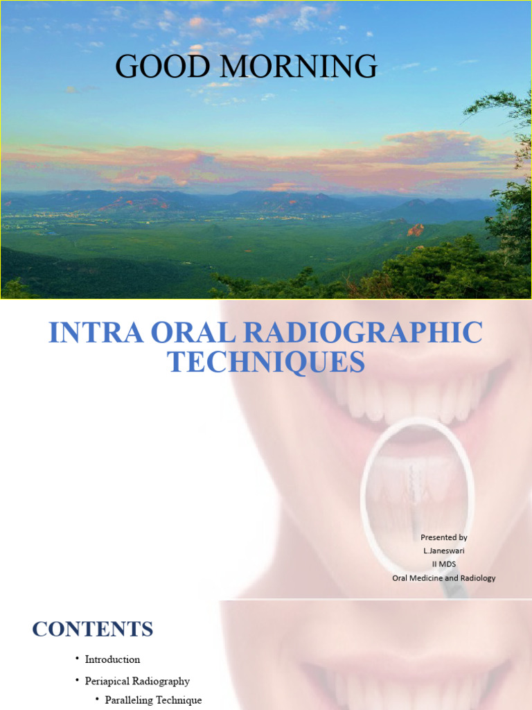 Seminar 4-Intra Oral Projections | PDF | Dental Anatomy | Radiography