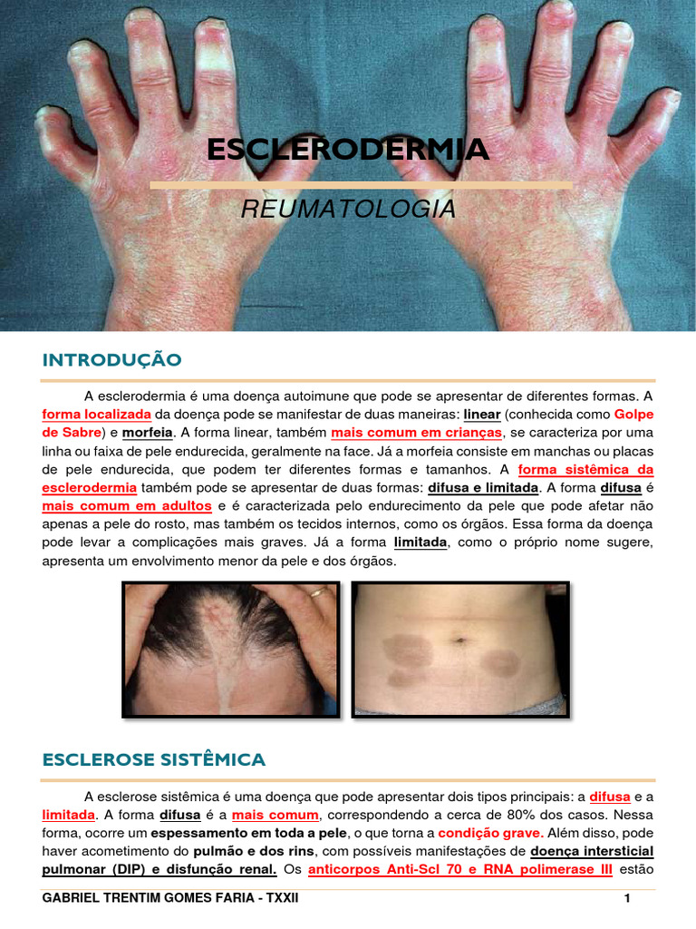 Esclerodermia: Tipos e Complicações | PDF | Especialidades médicas ...