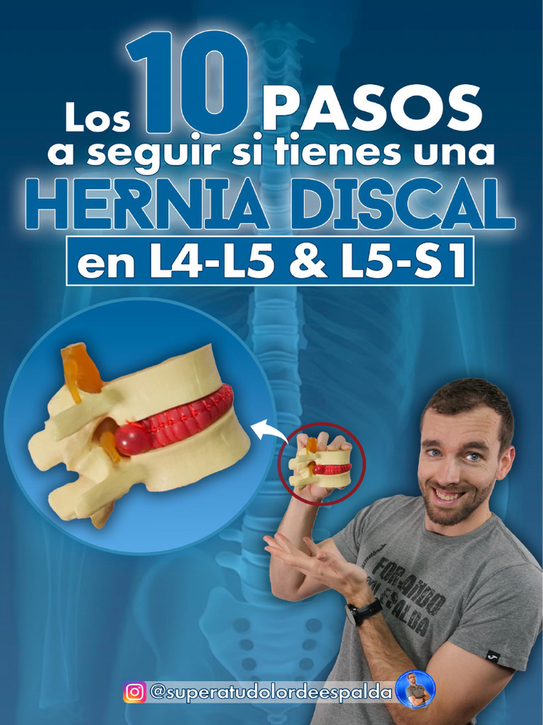 Las 10 Pasos A Seguir Si Tienes Una HERNIA DISCAL L4-L5 & L5-S1, Manual ...