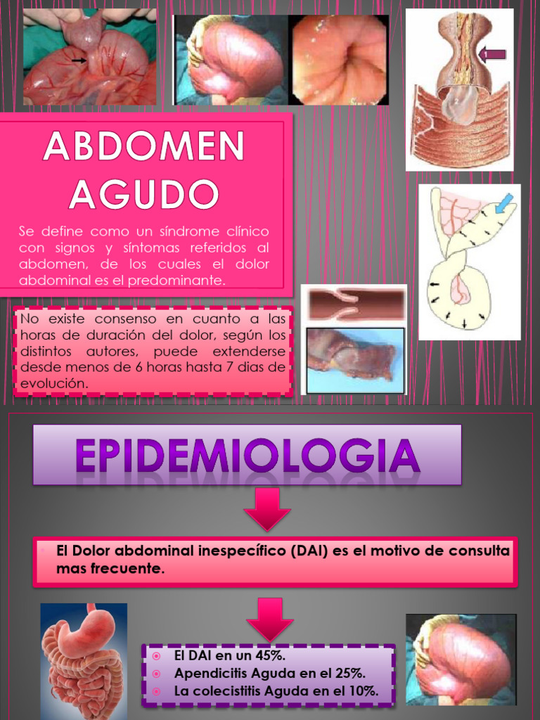 Causas y Diagnóstico del Abdomen Agudo | PDF | Medicina | Causas de la ...