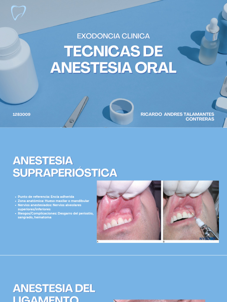 Técnicas de Anestesia Oral | PDF | Diente | Anatomía humana