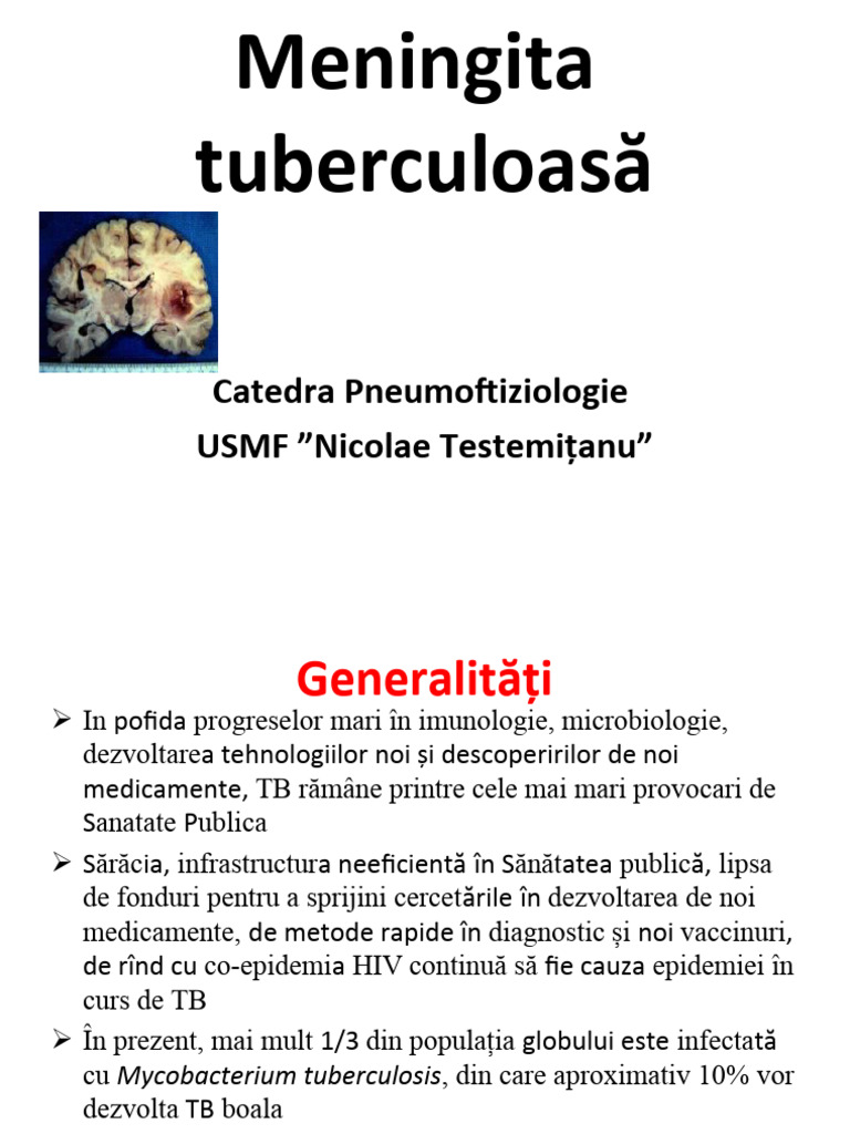 Meningita TB Kul | PDF