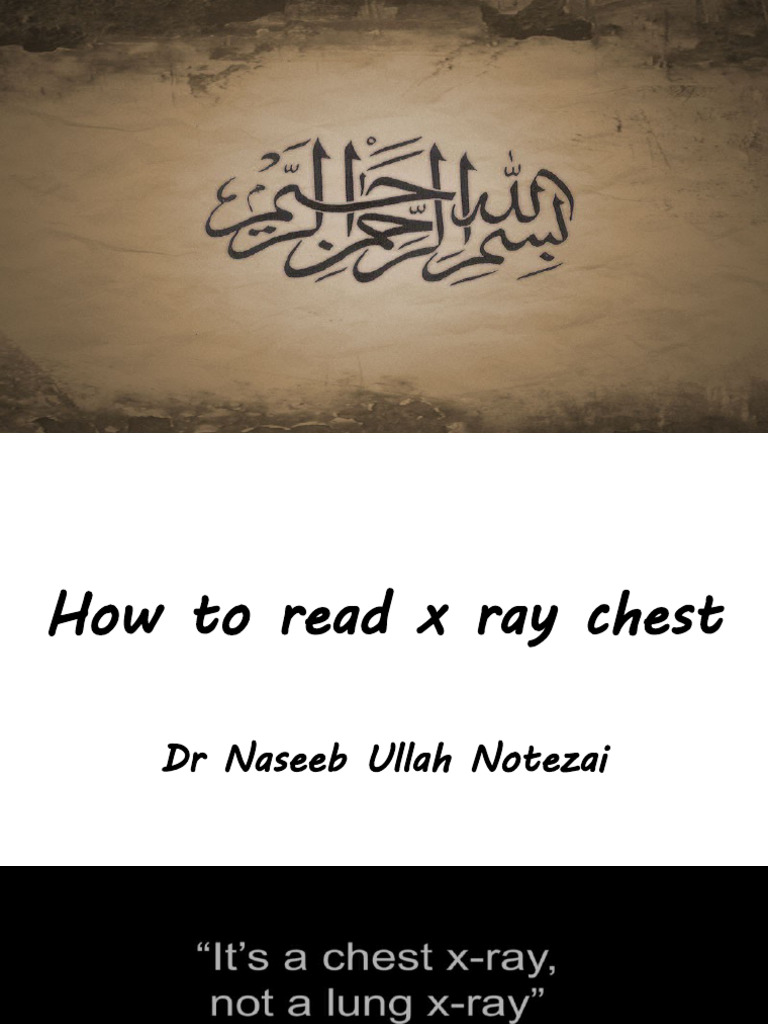 How To Read Chest X Ray - 1 | PDF
