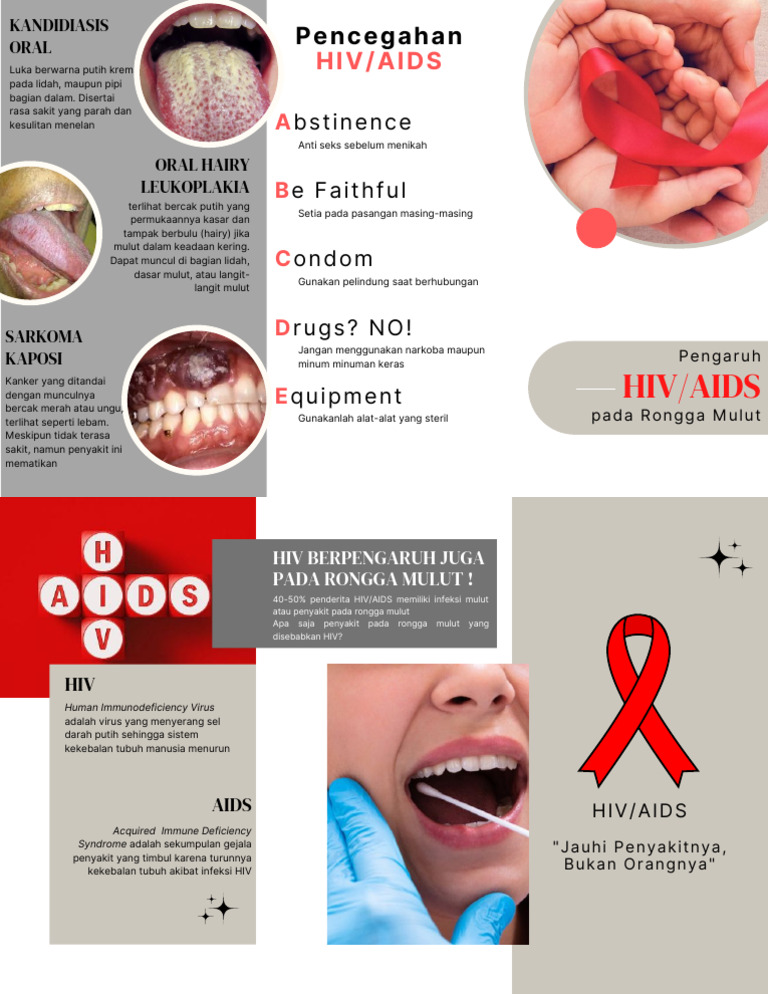 HIV Pada Rongga Mulut | PDF