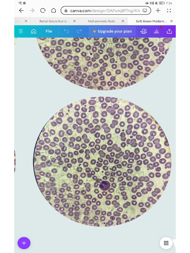 Platelet Count | PDF