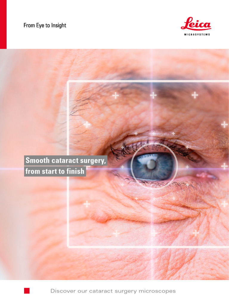 EN Cataract Brochure MC 0004492 11072022 1 | PDF | Microscope | Optics