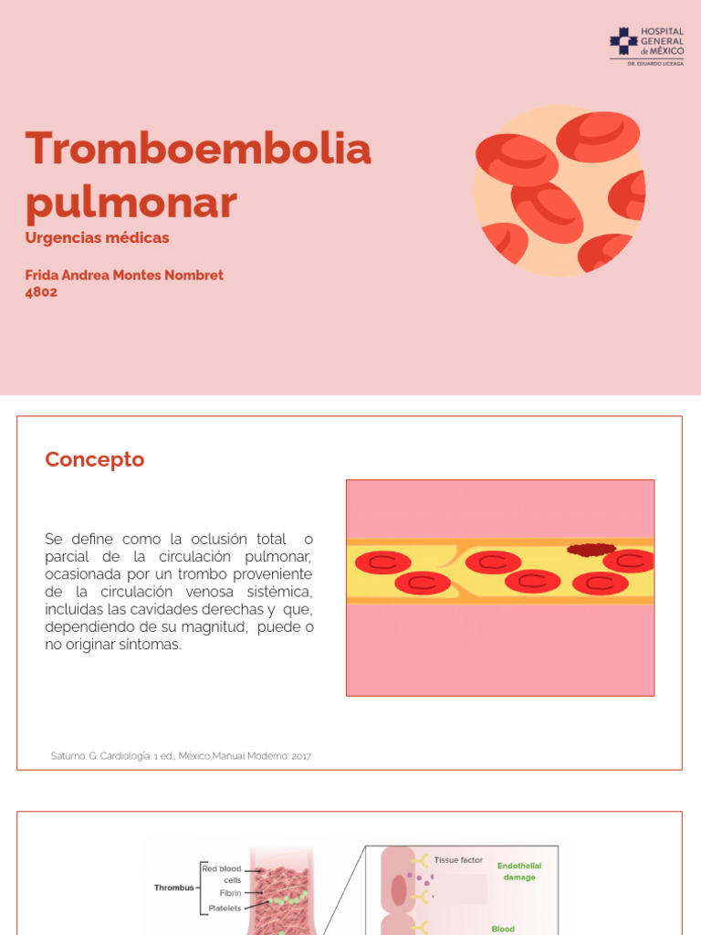 Tromboembolia pulmonar | Descargar gratis PDF | Electrocardiografia ...