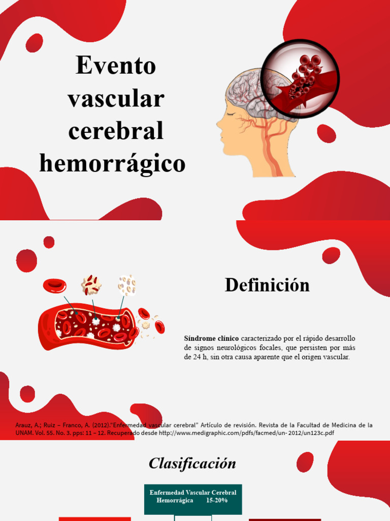 Evc Hemorragico | PDF | Hipertensión | Neurología