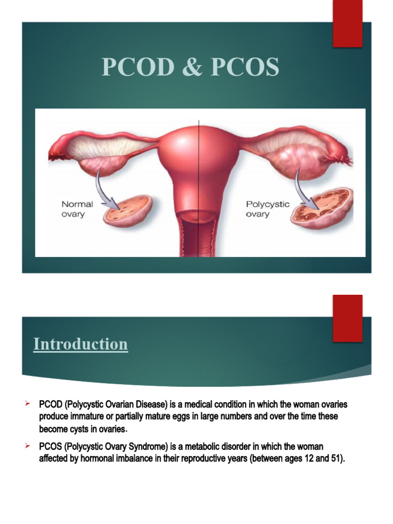 Polycystic Ovarian Disease | PDF | Polycystic Ovary Syndrome | Ovary