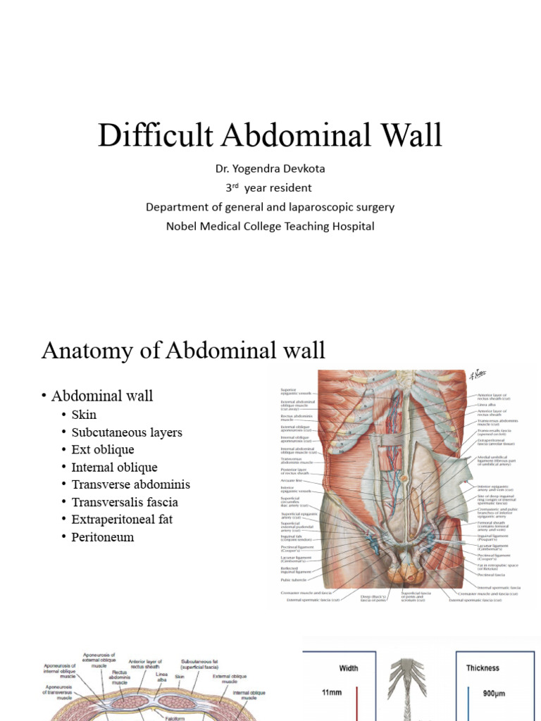 Difficult Abdominal Wall | PDF | Surgical Suture | Abdomen