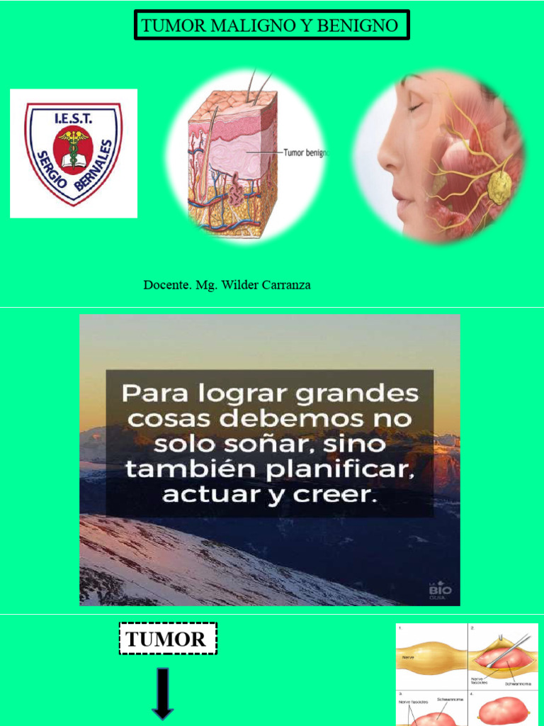 Clase II Tumor Maligno y Benigno | PDF | Neoplasias | Cáncer
