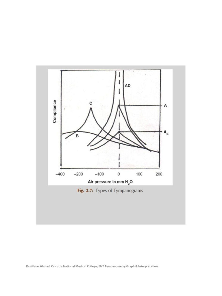Tympanograph For MBBS | PDF | Science & Mathematics