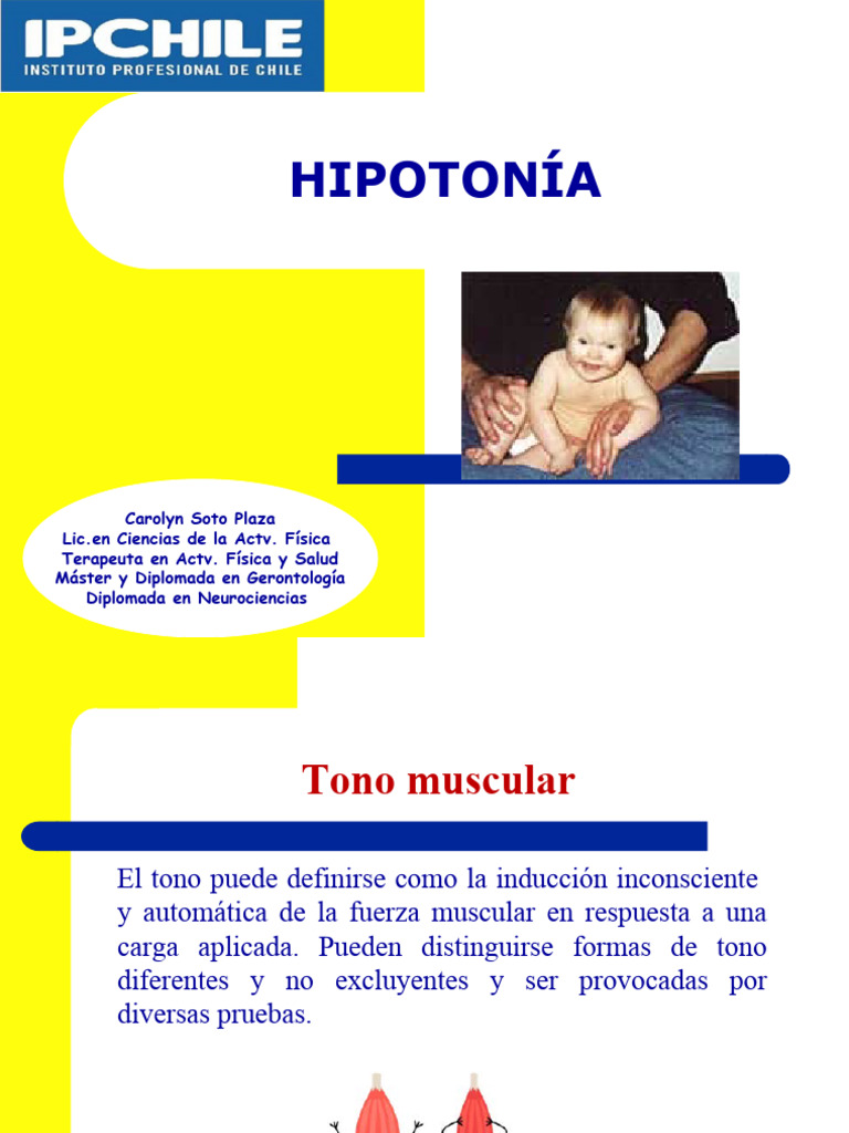 Hipotonía | PDF | Nervio | Enfermedades y trastornos