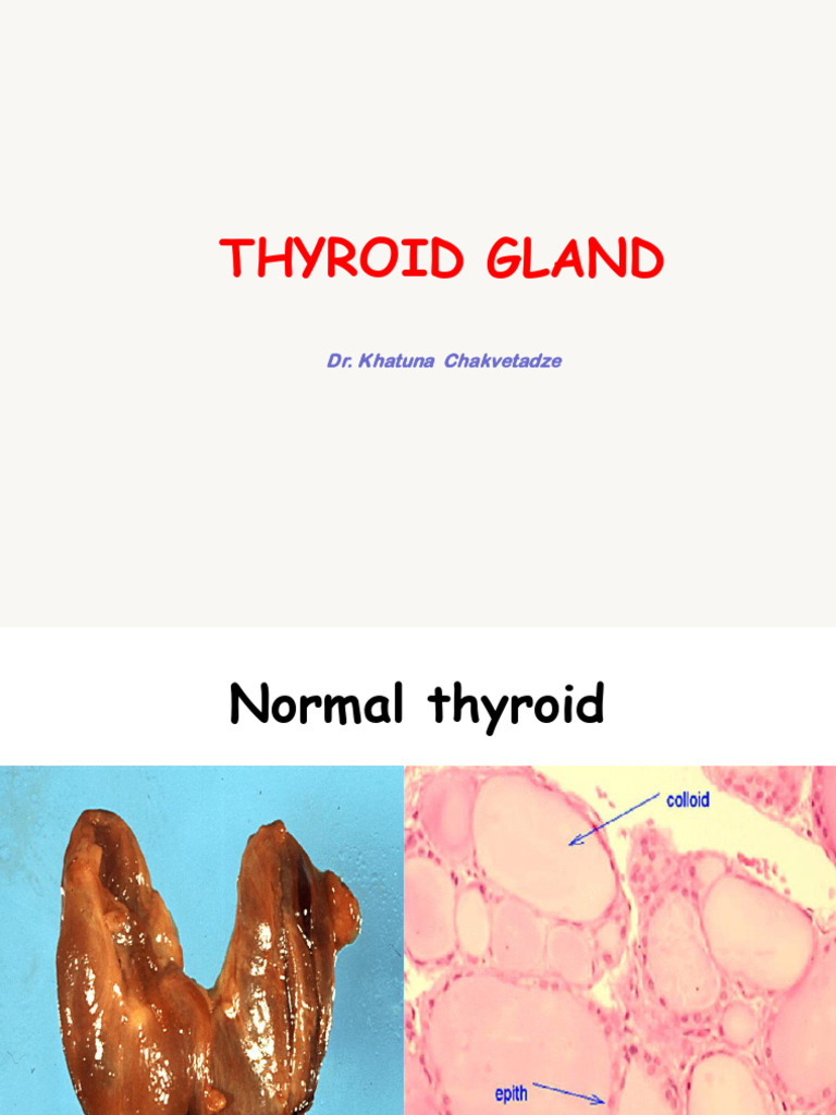 Thyroid Gland | Download Free PDF | Hypothyroidism | Thyroid