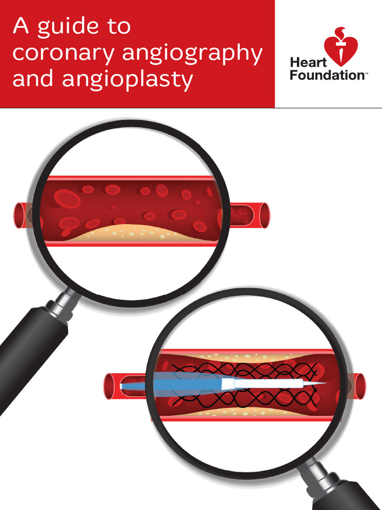 Coronary Angiography & Angioplasty Guide | PDF | Angiography | Stent