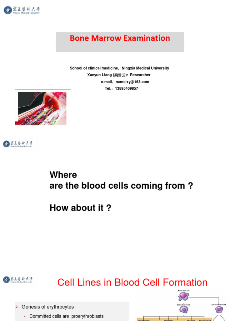 Bone Marrow Examination | PDF | Leukemia | Bone Marrow Bone Marrow Examination | PDF | Leukemia | Bone Marrow