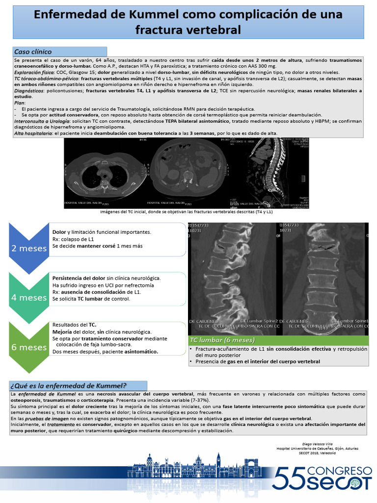 Caso clínico: Enfermedad de Kummel y fracturas | PDF | Neurología ...