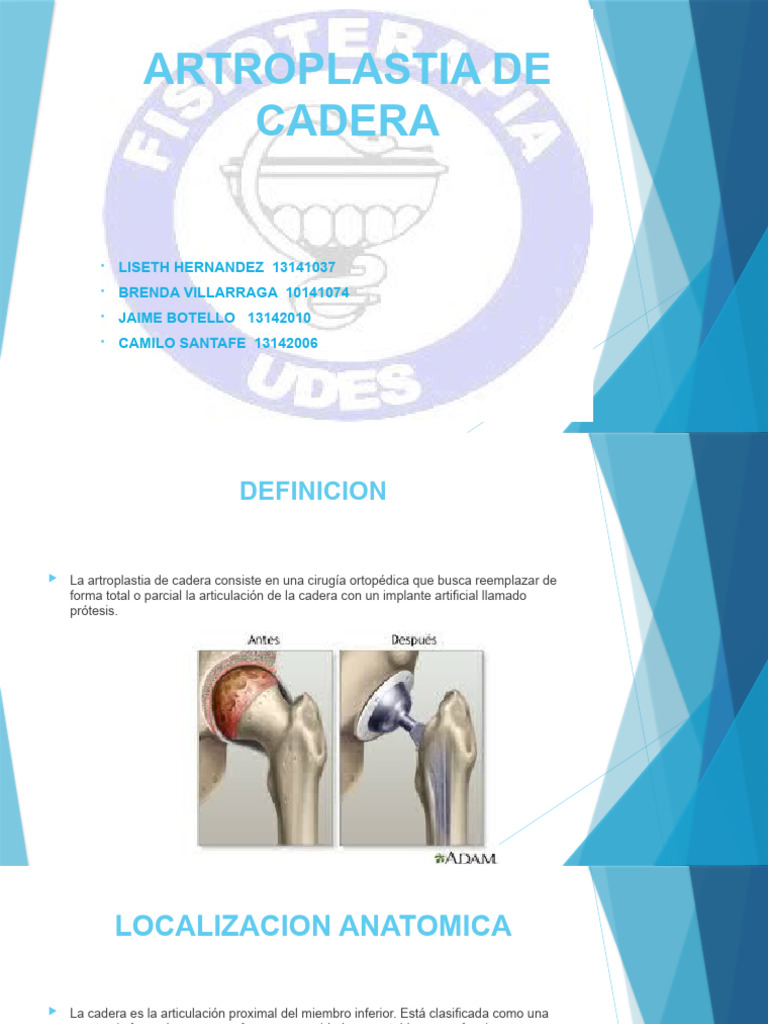 DIAPOSITIVAS ARTROPLASTIA DE CADERA | PDF | Articulación | Sistema ...