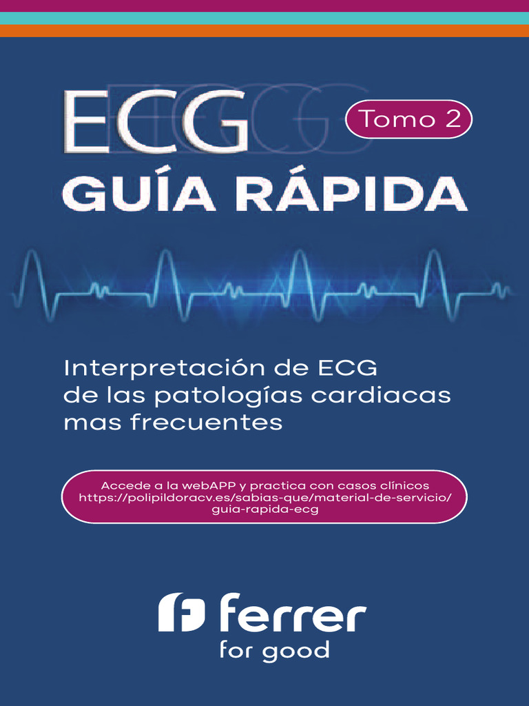 9u2 Guia Rapida Ecg Tomo 2 PDF Version Digital | PDF ...
