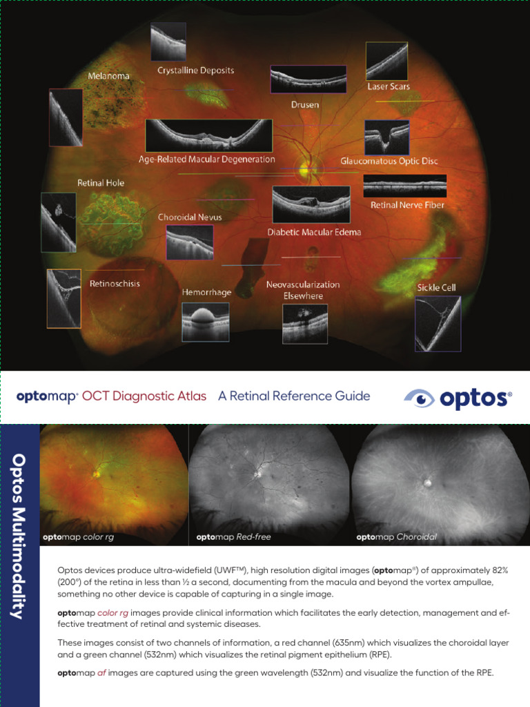 Booklet Atlas Oct Us | PDF | Retina | Anatomy