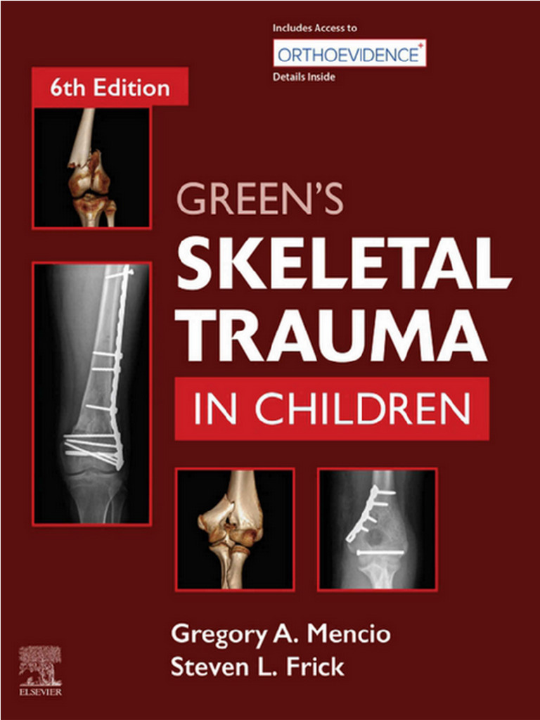 (2020) Greens Skeletal Trauma in Children 6th Edition | PDF ...