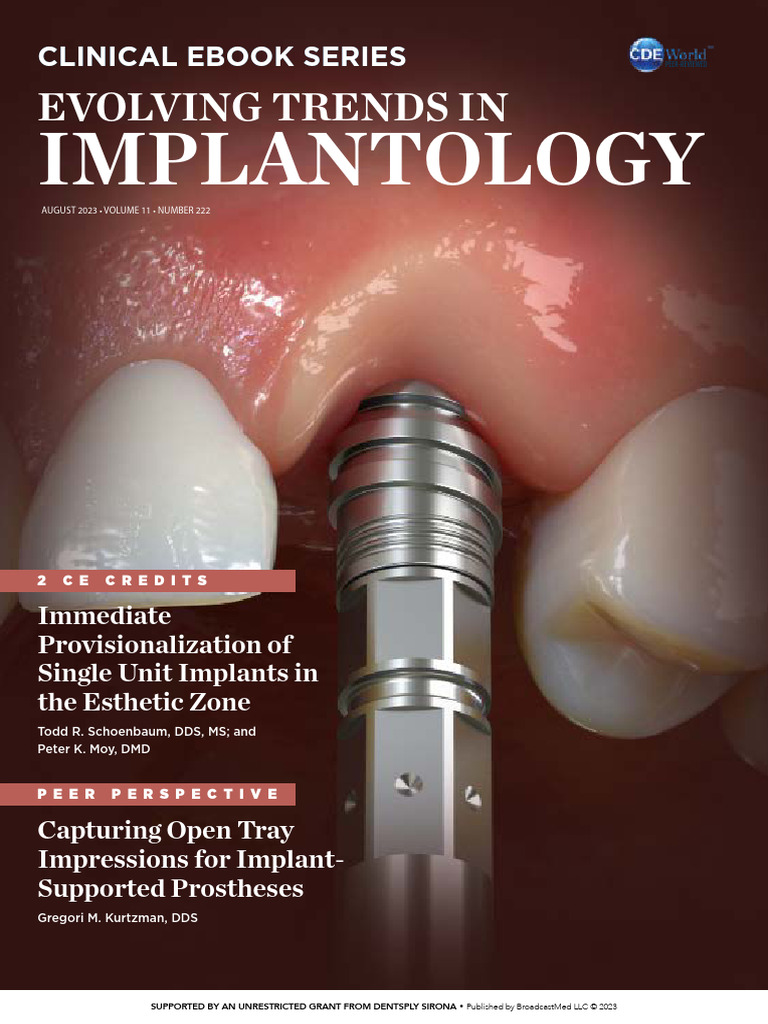 Evolving Trends in Implantology | PDF | Dental Implant | Periodontology