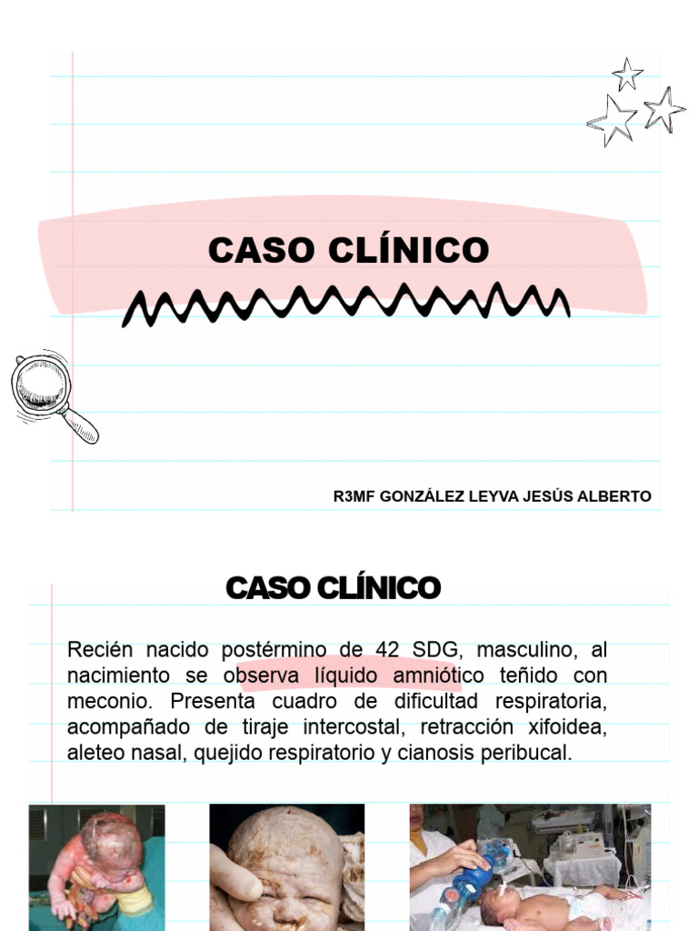 Sindrome de Aspiración Meconial (1) - 1 | PDF | Especialidades Medicas ...