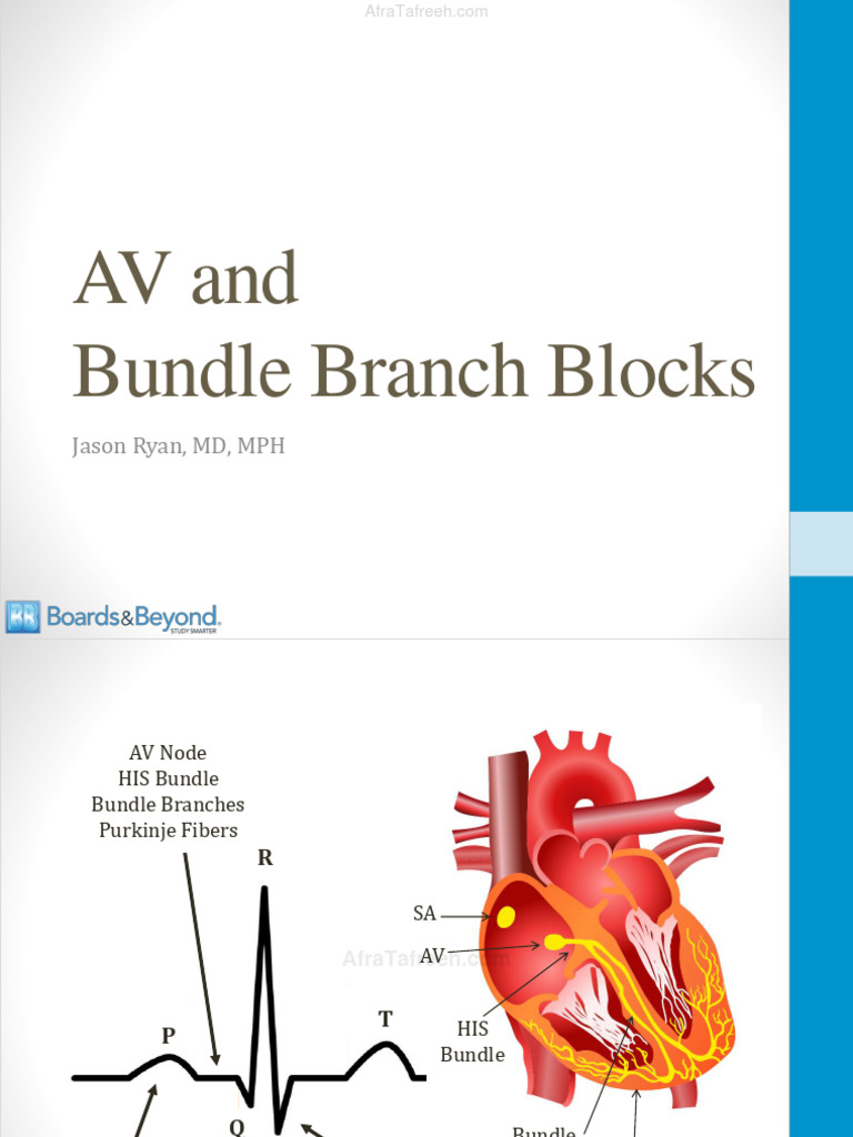 AV and Bundle Branch Blocks Atf | PDF | Cardiac Electrophysiology | Heart
