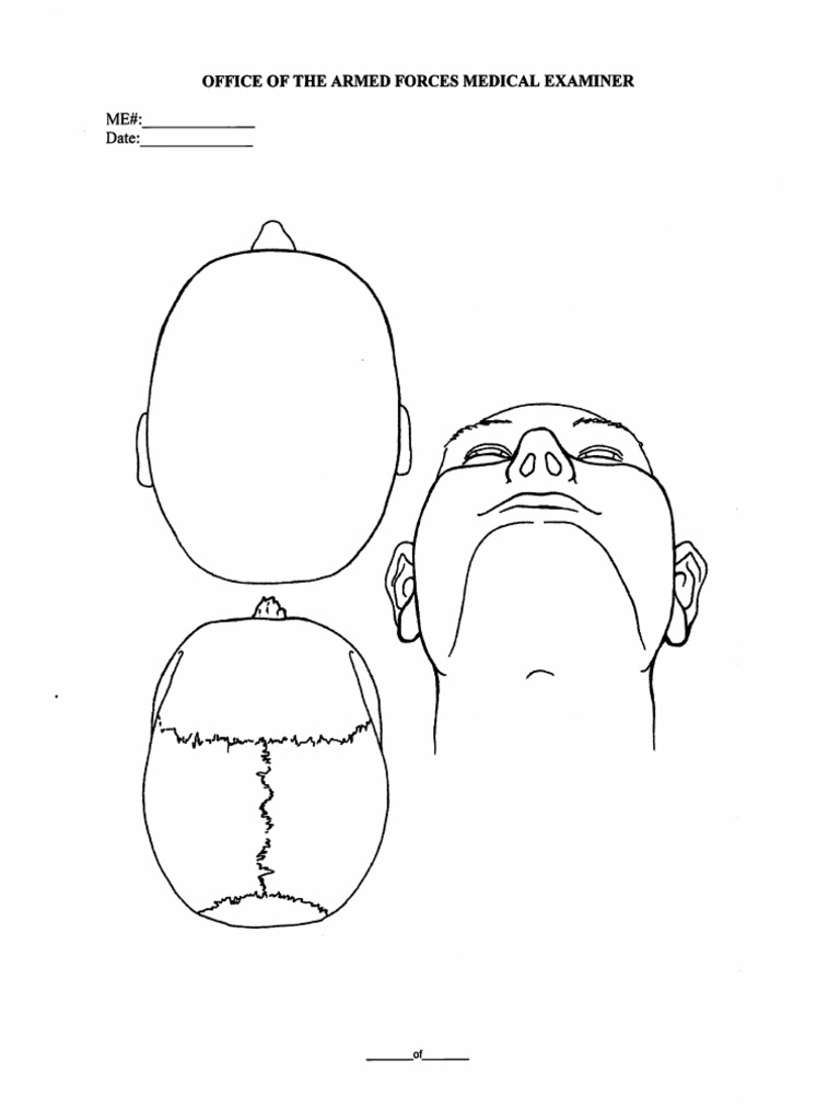 AutopsyDisgram Extended Neck | PDF