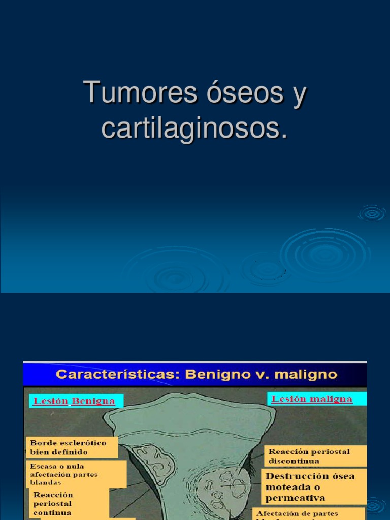 Tumores Óseos y Cartilaginosos | PDF | Hueso | Sistema esquelético