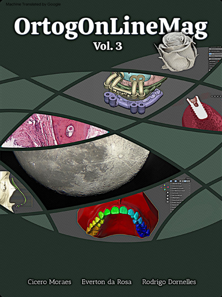 3D Mesh Reconstruction from DICOM Files | PDF | Tomography | Pixel