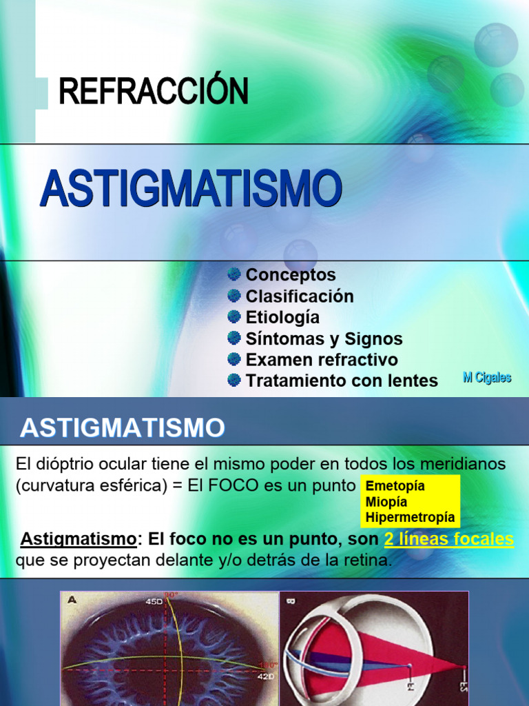 4 - Astigmatismo | PDF | Lentes | Sentidos