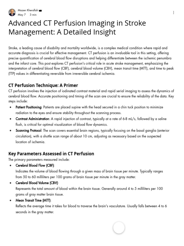 Advanced CT Perfusion Imaging in Stroke Management - A Detailed Insight ...