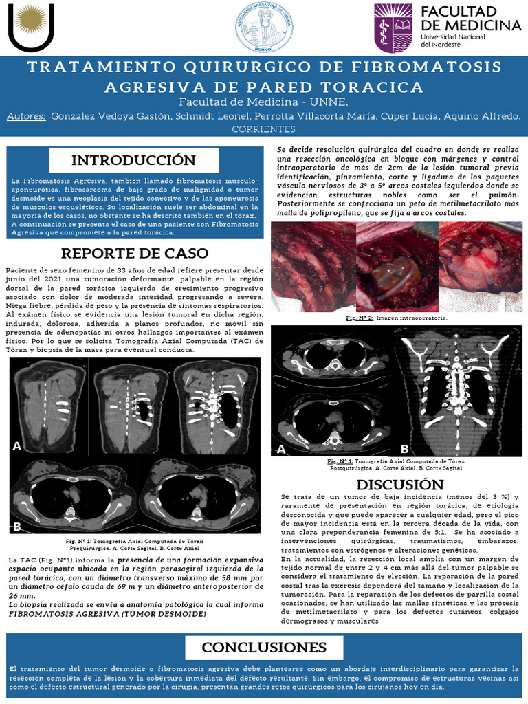 Póster de Tumor Desmoide | PDF | Tórax | Biopsia