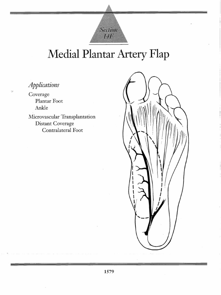Mathes CH14 Medial Plantar Artery Flap | PDF