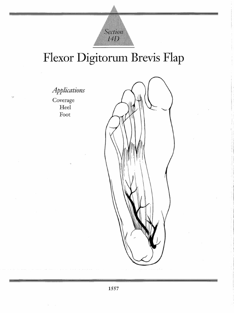 Mathes CH14 Flexor Digitorum Brevis Flap | PDF