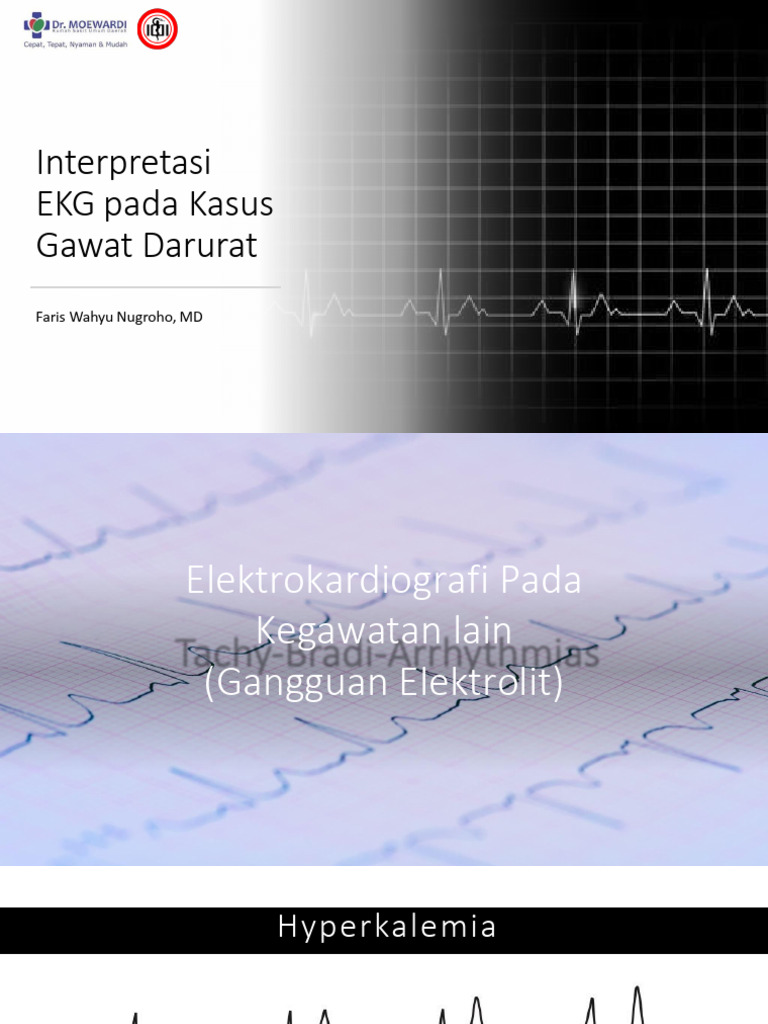 Elektrokardiografi Pada Kegawatan Lain (Gangguan Elektrolit) - Dr. Faris, SP - JP, FIHA | PDF ...