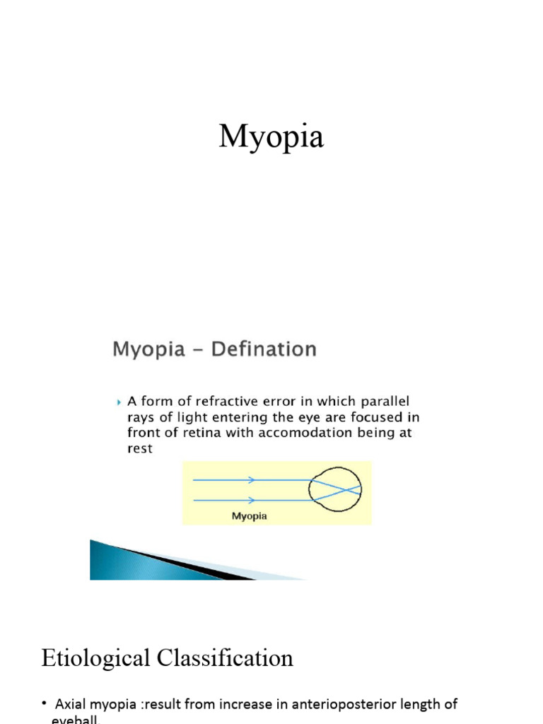 Myopia Simple | PDF | Myopia | Human Eye