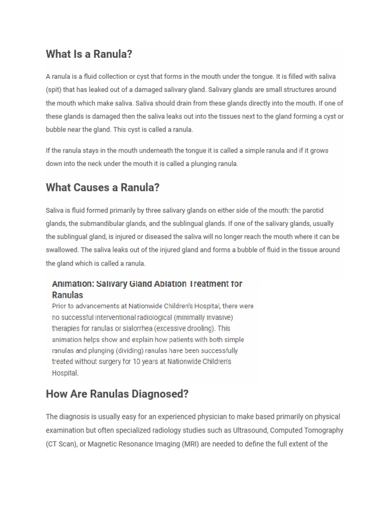 RANULA | PDF | Medical Imaging | Systematic Review