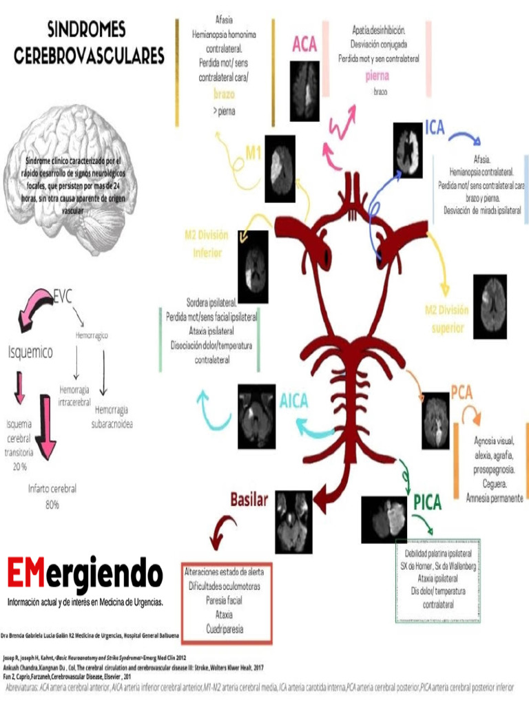 Síndromes-Cerebrovasculares | PDF