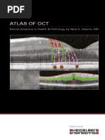 Interpreting Retinal OCT: A Comprehensive Guide | PDF | Retina ...